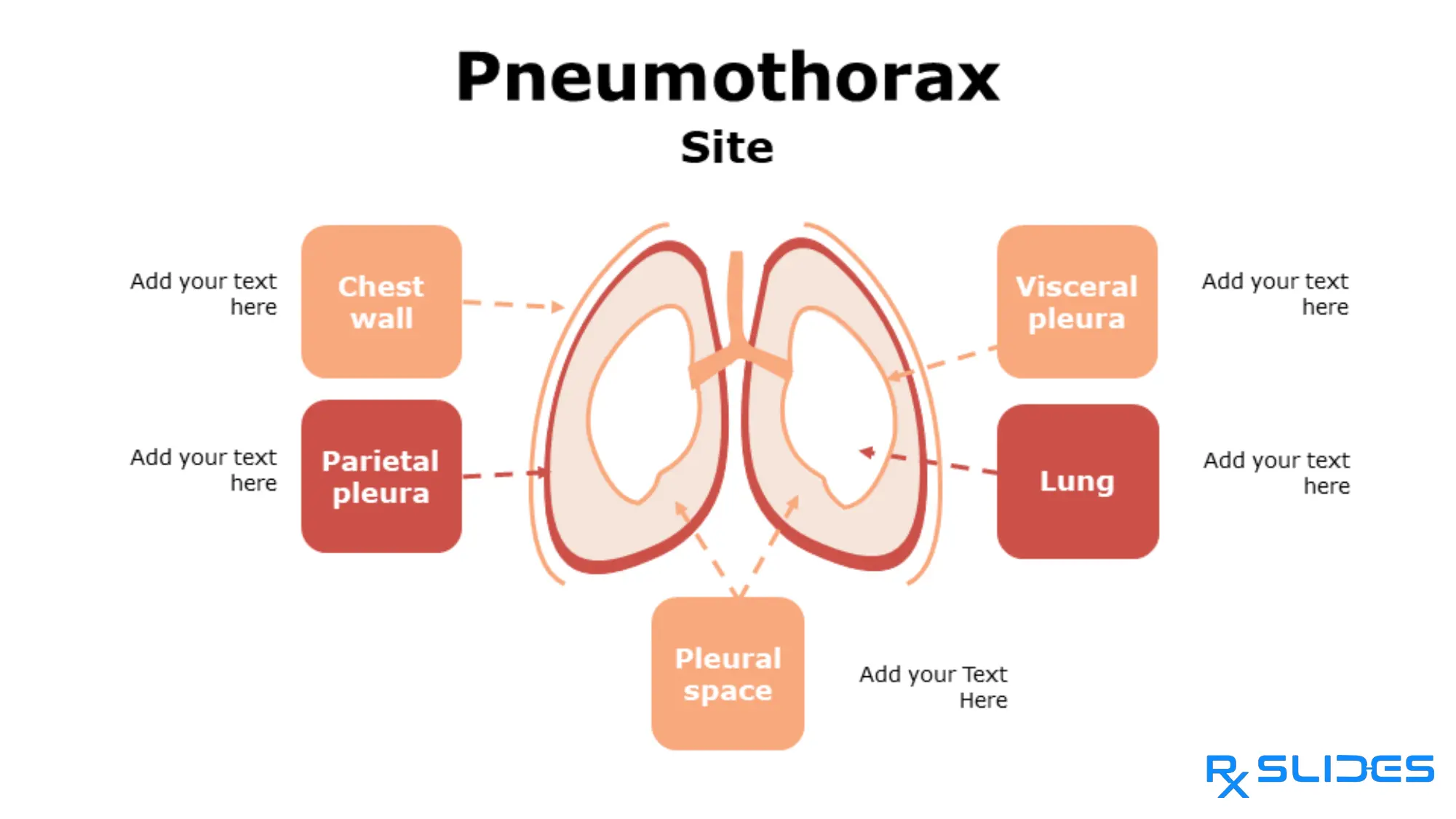 Download Pneumothorax PowerPoint Template|RxSlides